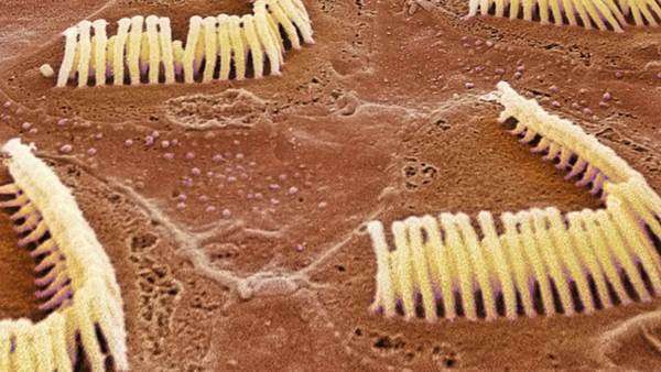 Inner ear hair cells. Coloured scanning electron micrograph (SEM ...