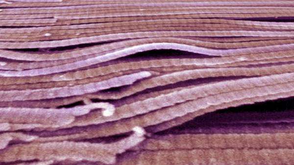 Collagen. Scanning electron micrograph (SEM) - Stock Video Footage ...