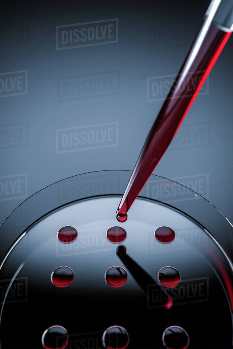 Blood sample tested on petri dish in laboratory - Royalty-free Stock ...