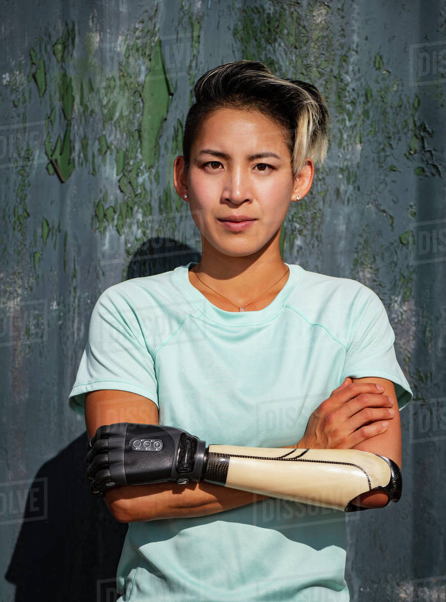 Portrait of athletic woman with prosthetic arm - Royalty-free Stock ...