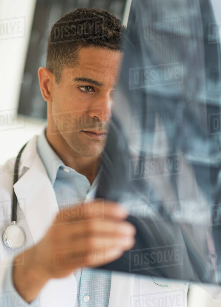 Male doctor reading MRI scan - Stock Photo - Dissolve