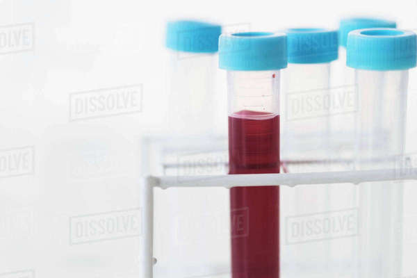 Blood sample in test tube - Royalty-free Stock Photo | Dissolve