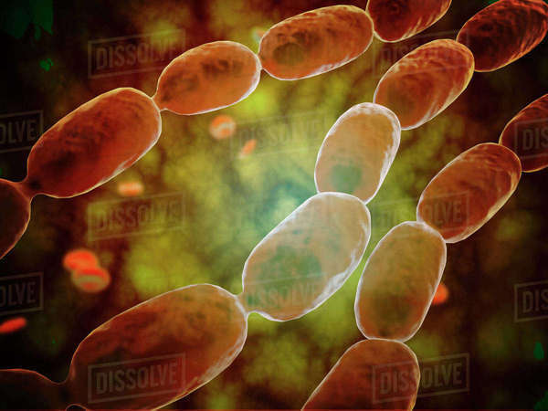 Microscopic view of bacterial pneumonia. Bacterial pneumonia is a type ...