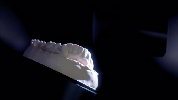 Dental prosthetic restoration. Denturist is making 3D model for ...