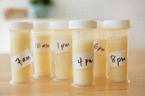 Vials of breast milk with time - Stock Photo - Dissolve
