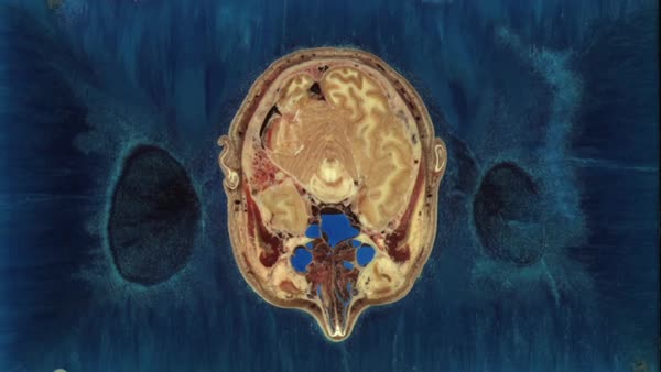 A compilation of cross-sectional photographs of a male cadaver used in ...