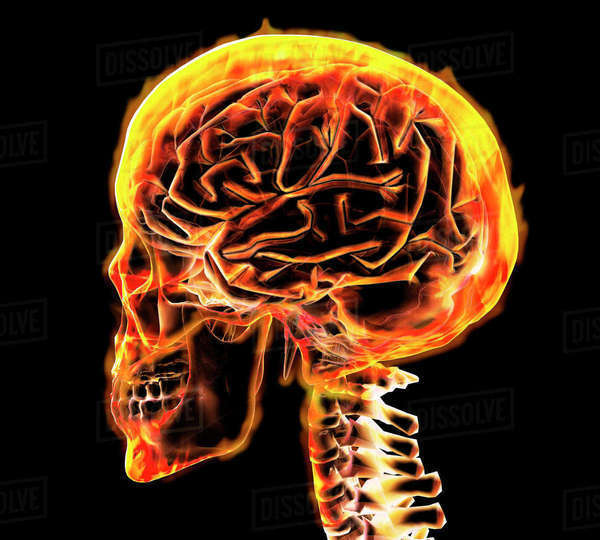 Close-up of an X-Ray image of human skull representing headache ...