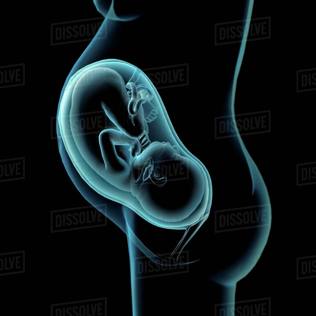 Pregnancy Anatomy,Xray side view of fetus in utero, Black background ...