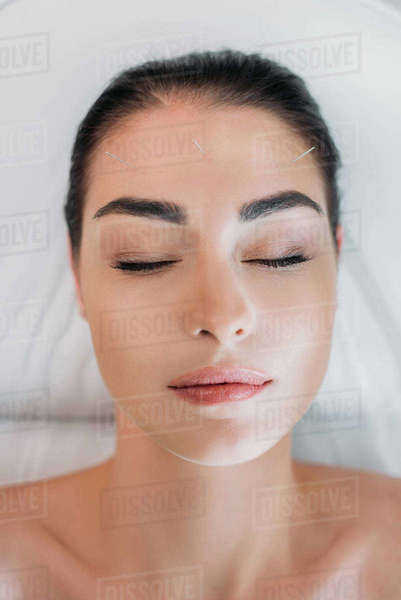 Overhead view of woman relaxing while having acupuncture therapy in spa ...