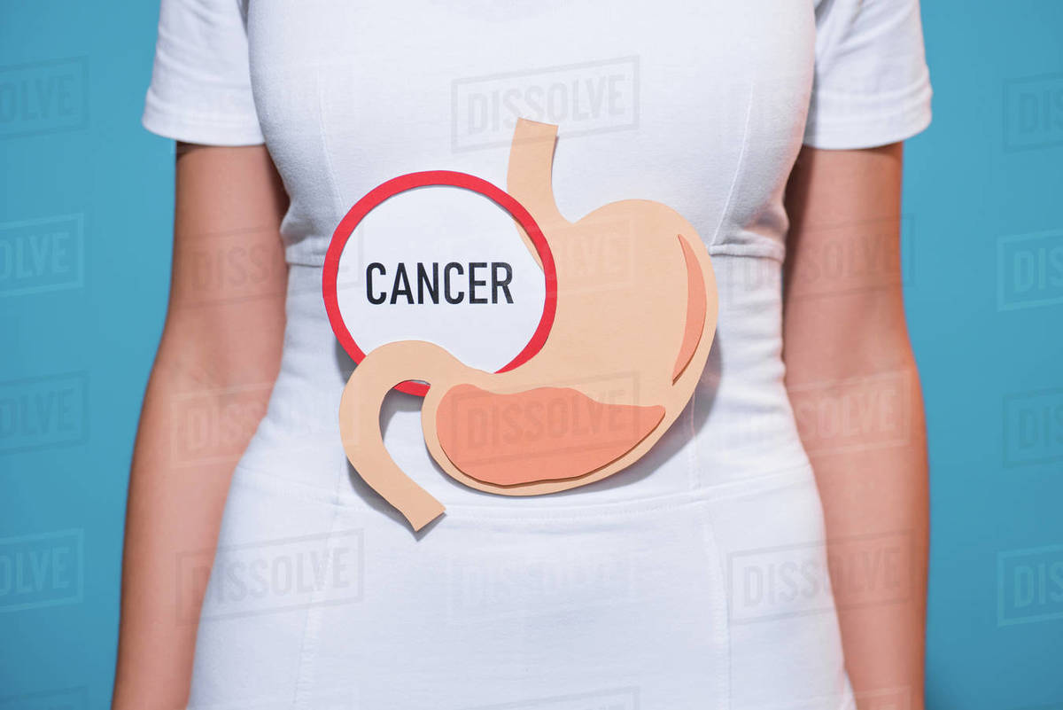 Cropped shot of woman with paper crafted stomach and cancer lettering ...
