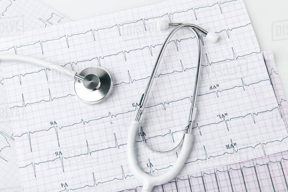 Stethoscope laying on paper with cardiogram isolated on white ...