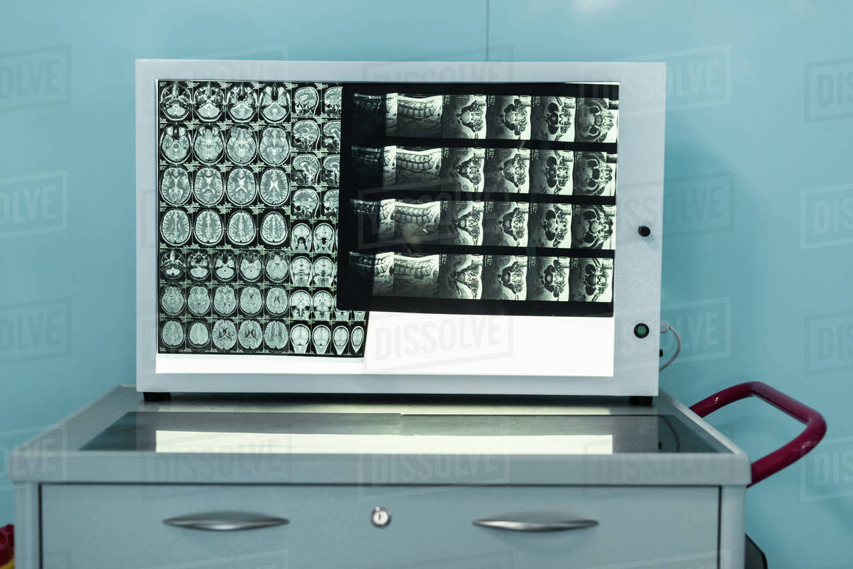 Medical screen with x-ray in modern hospital - Royalty-free Stock Photo ...