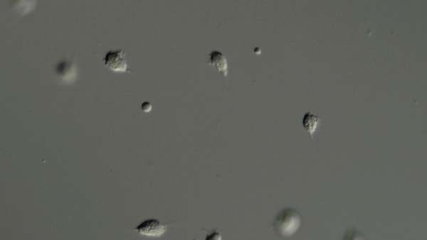Trichomonas vaginalis parasites, light microscopy - HD Rights-managed ...