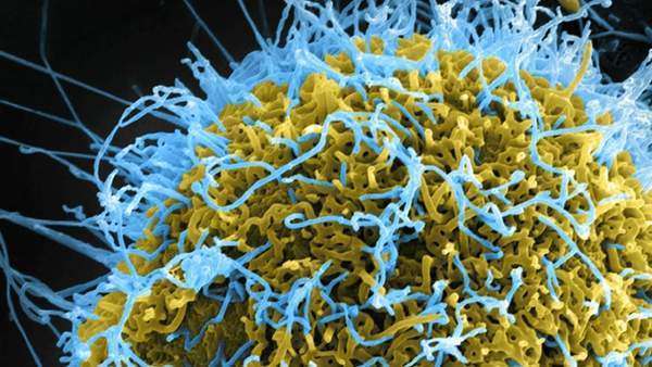 Coloured scanning electron micrograph (SEM) of Ebola virus particles ...