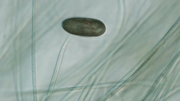 Algal cell (Cryptomonas) swimming in blue-green algae. It uses its ...