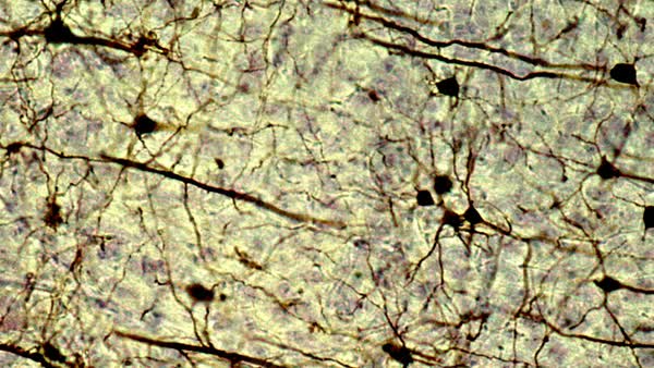 Animated brightfield light micrograph of pyramidal neurons (nerve cells ...