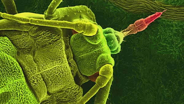 Animated coloured scanning electron micrograph (SEM) of a pea aphid ...