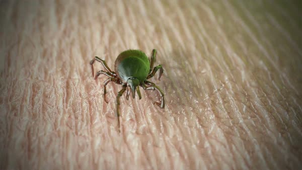 Tick walking along human skin, animation. - Stock Video Footage - Dissolve