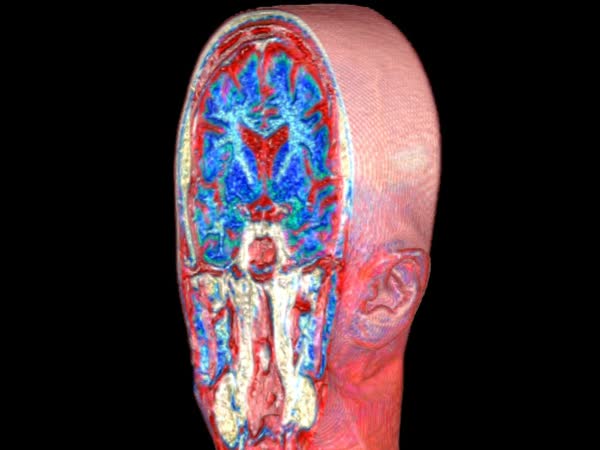 Brain and spinal cord, rotating coronal MRI scan - Stock Video Footage ...