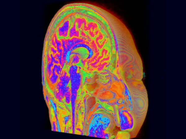 Brain and spinal cord, rotating sagittal MRI scan - Stock Video Footage ...