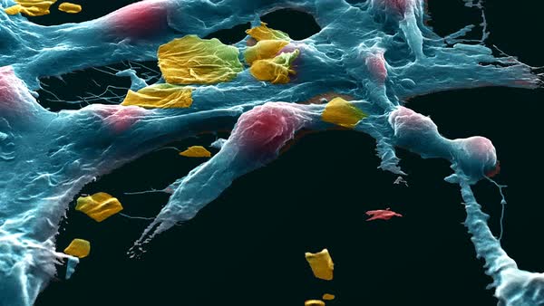 Brain cancer STEM cells in 3D - Stock Video Footage - Dissolve