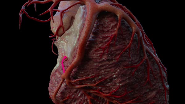 Coronary arteries, atrioventricular nodal artery - HD Rights-managed ...