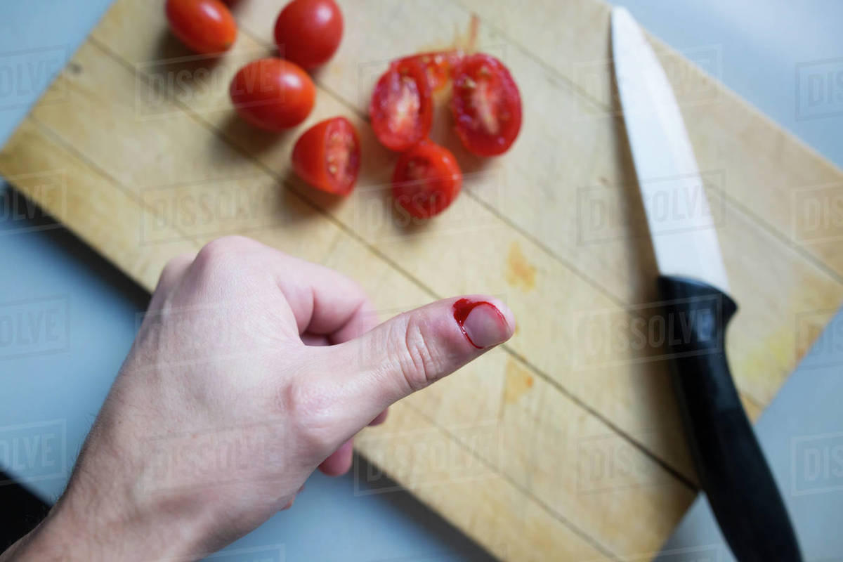 Young man finger cut while cooking a lunch, bleeding - Royalty-free ...