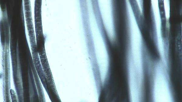 Microscopic view of Phormidium sp. blue green algae as they slowly into ...