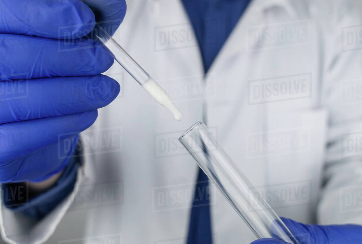 Medical laboratory assistant checks a test tube with sperm. Spermogram ...