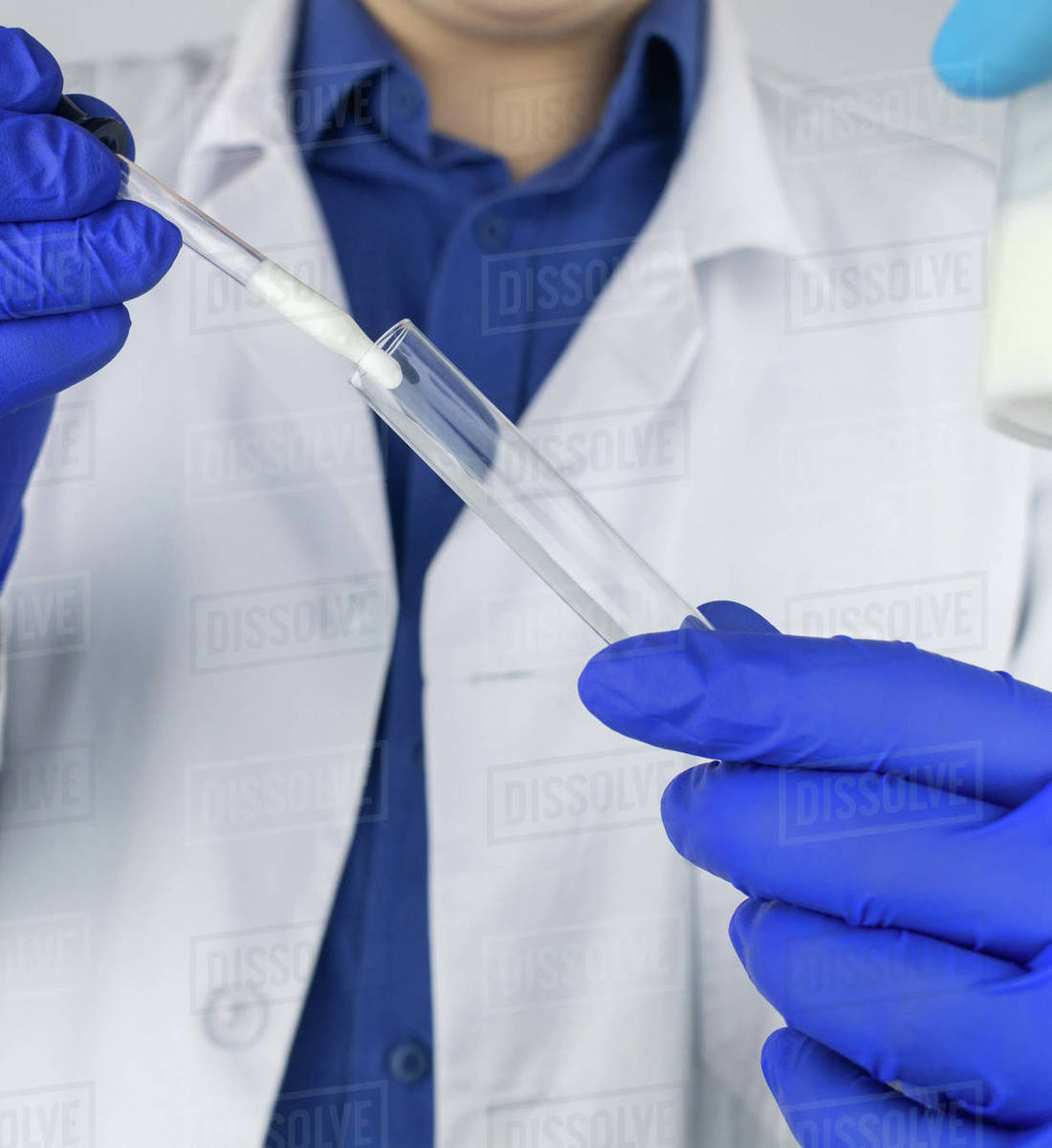 Medical laboratory assistant checks a test tube with sperm. Spermogram ...