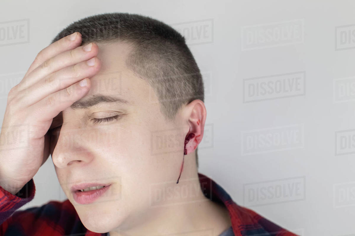 A man whose ear is bleeding. Vascular rupture, damage to the tympanic ...