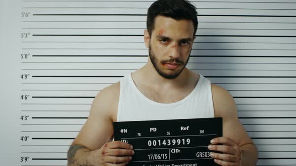 In a police station arrested beaten man poses for side, front view ...