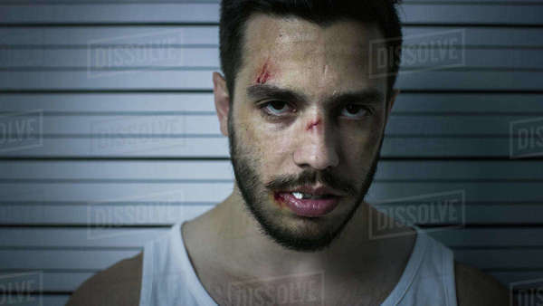 Close-up Portrait Shot of an Arrested Beaten Man in a Police Station ...