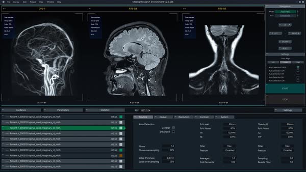 Mammogram Breast Scan Mock-up with Multiple Windows and Data. Medical ...
