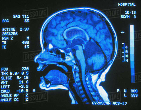 Gyro Scan - Stock Photo - Dissolve