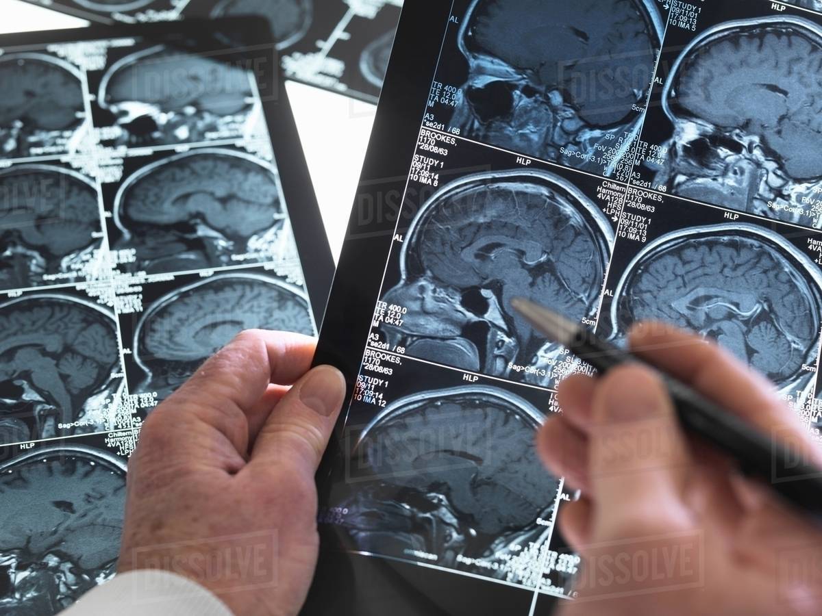 Close up of doctor viewing a healthy brain scan - Stock Photo - Dissolve