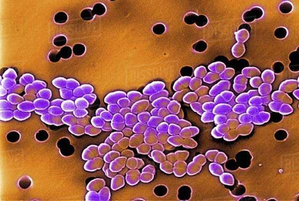 SEM of Vancomycin resistant Enterococci bacteria - Stock Photo - Dissolve