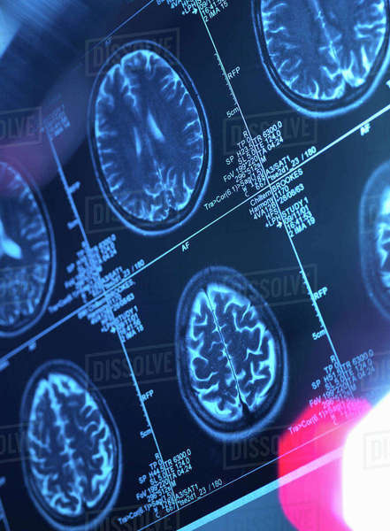 Human brain scan in a neurology clinic - Royalty-free Stock Photo ...