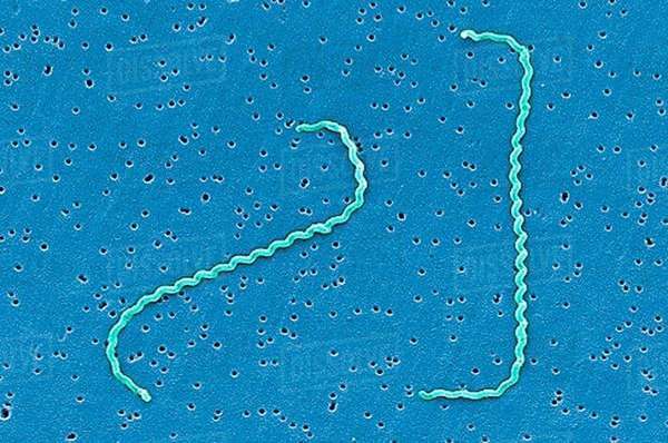 Scanning Electron micrograph, Leptospira bacteria - Stock Photo - Dissolve