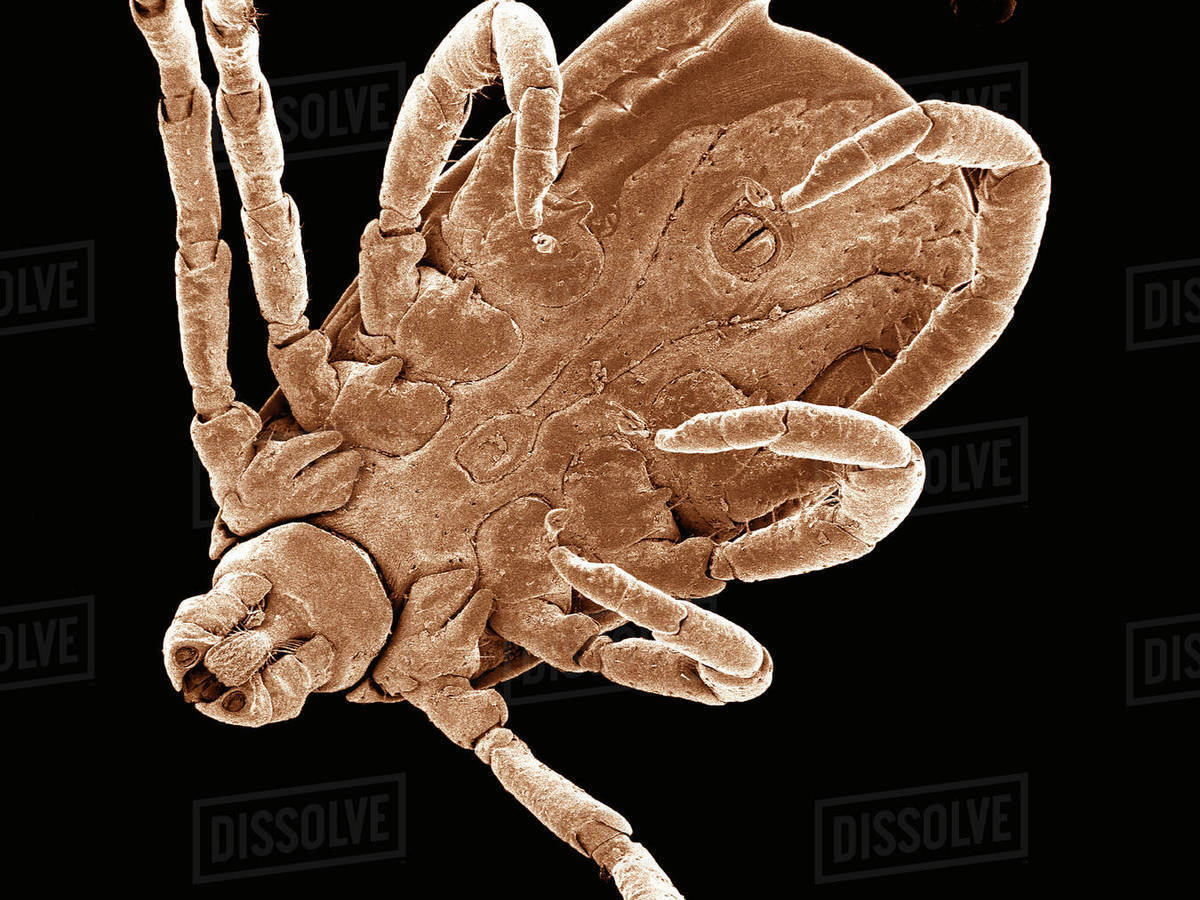 Ventral surface of a dog tick (Acari: Dermacentor sp.) imaged in a ...