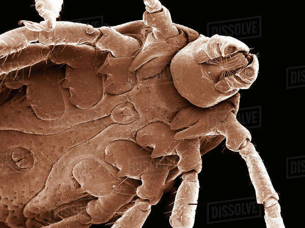 Ventral surface of a dog tick (Acari: Dermacentor sp.) imaged in a ...