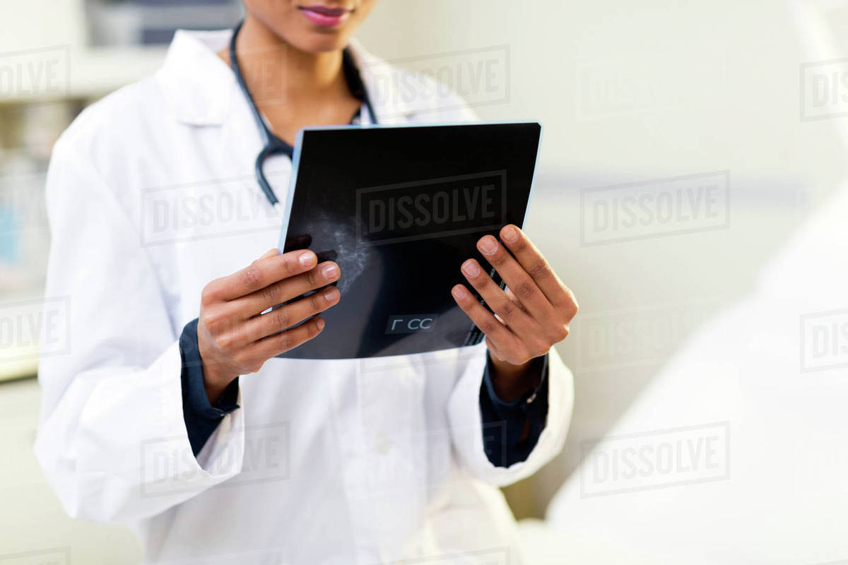 Doctor looking at xray image - Royalty-free Stock Photo | Dissolve
