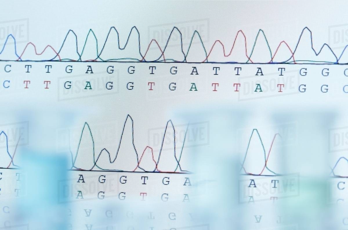 DNA sequencing. Computer monitor displaying results of automated DNA ...