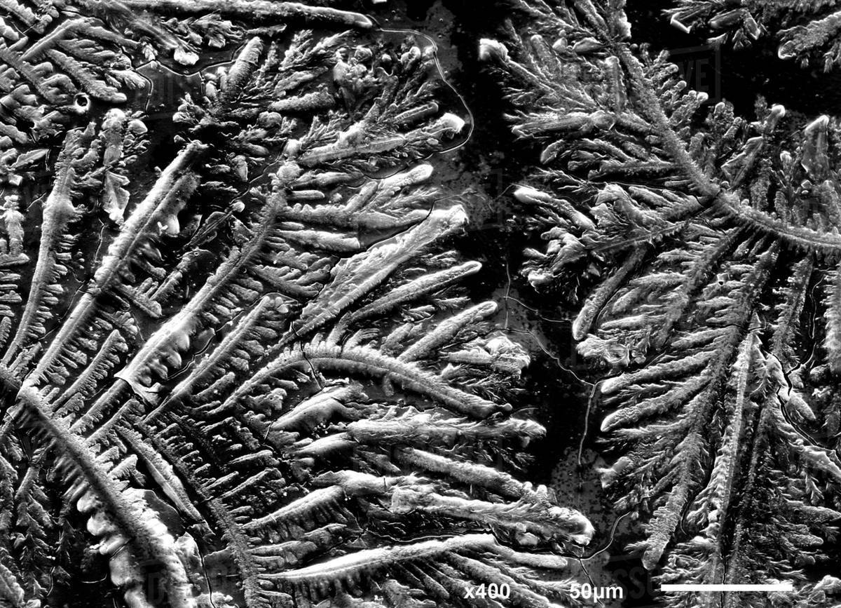 Complexity of human sadness teardrop imaged in a scanning electron ...