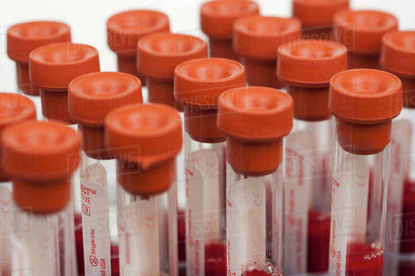 Blood samples in test tubes - Royalty-free Stock Photo | Dissolve